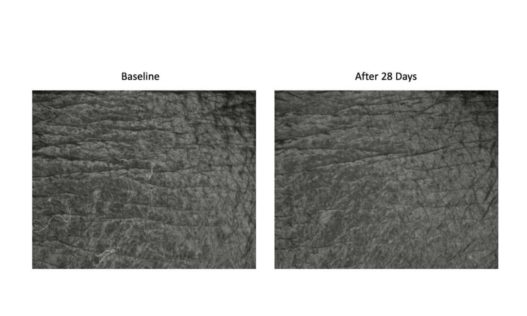 Visioscan® Surface Evaluation Clinical Study – Delavie Sciences
